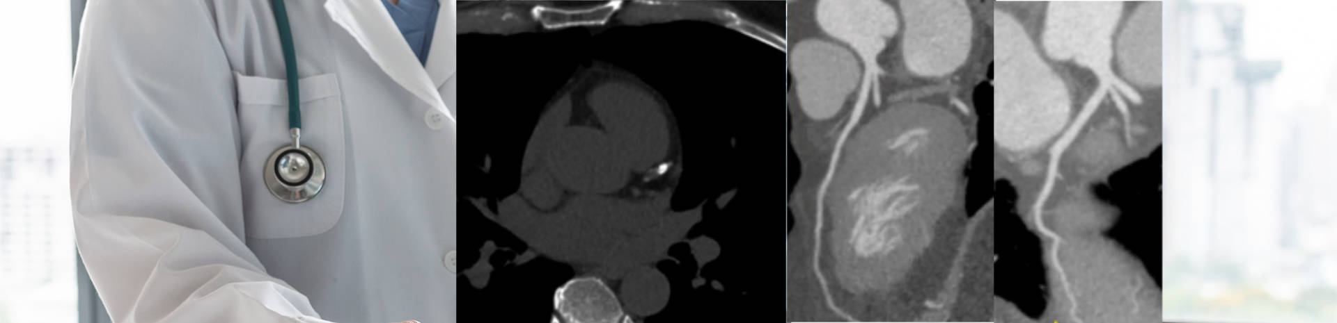 Cardiac Imaging - Mountain West Medical Center